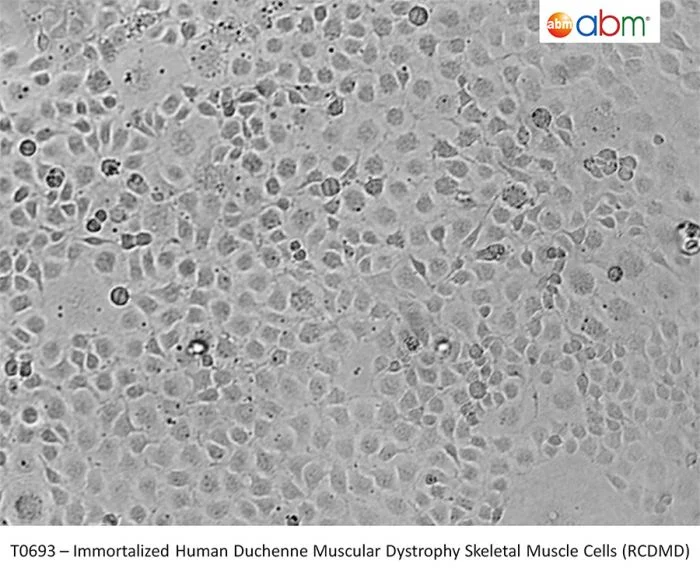 Immortalized Human Duchenne Muscular Dystrophy Skeletal Muscle Cells ...
